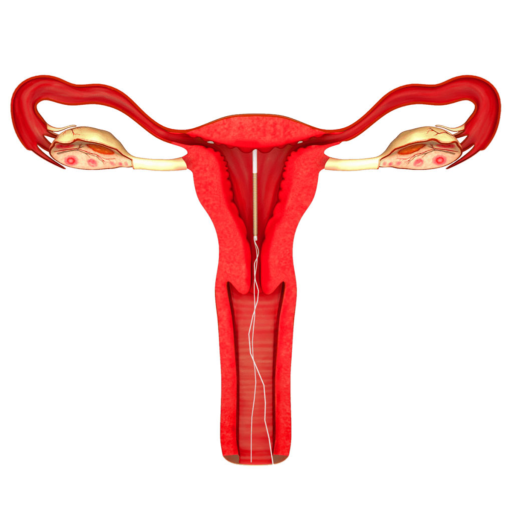 Emergency Contraception Singapore Ezra Clinic 6592