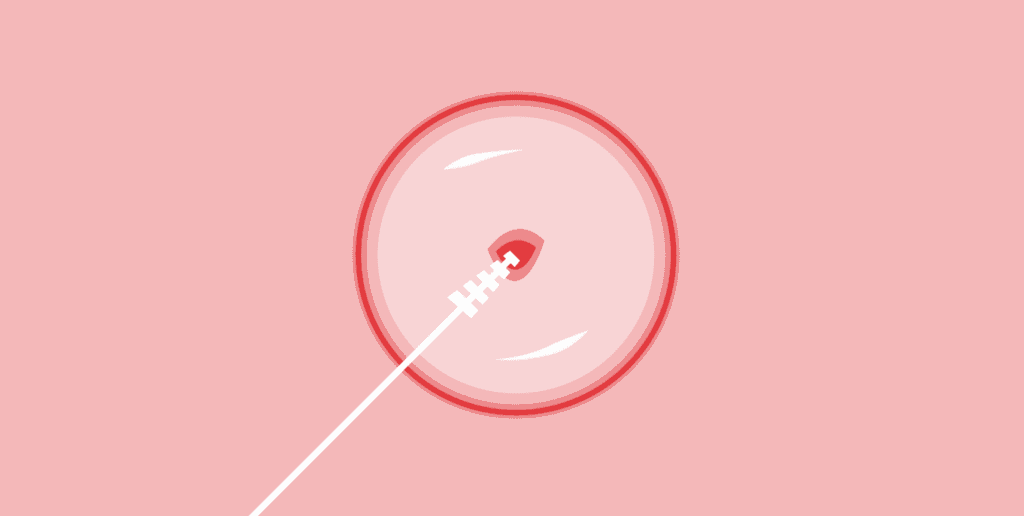 The Ultimate Guide To Getting A PAP Smear –The Best Way To Detect Early ...
